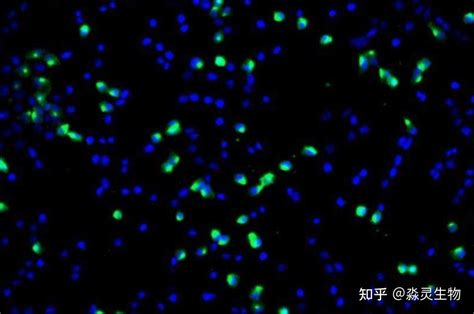 实战分享 细胞爬片免疫荧光实操分享 知乎
