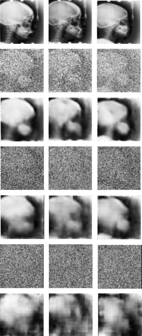 Figure 9 From Medical Image Denoising Using Convolutional Denoising