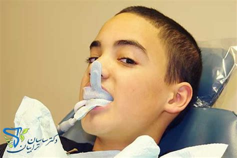 فلوراید تراپی کودکان