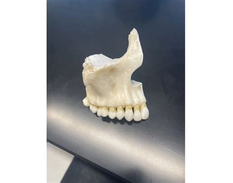 Maxilla Bone Anterior Anatomy Lab Quiz