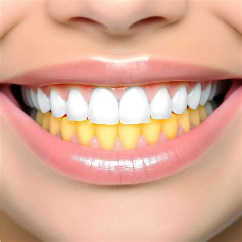 The Simple Mistake Turning Your Teeth Yellow And When Not To Brush