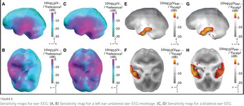 Figure 5 From Ear Eeg Sensitivity Modeling For Neural Sources And