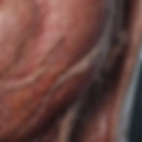 Echogenic Lesions On The Liver A Comprehensive Review