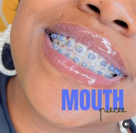 7 Braces Colors Ideas Braces Colors Braces Cute Braces