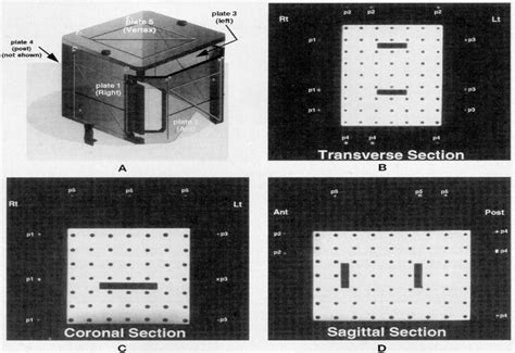 Stereotactic Localization With Magnetic Resonance Imaging A Neurosurgery