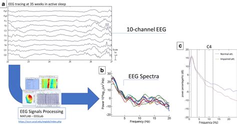 The Processing Procedure Of Transformation The Eeg Tracing Panel A Of