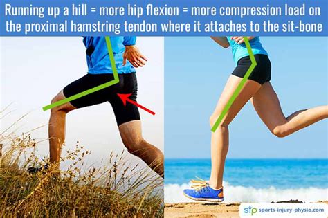 Running With Proximal Hamstring Tendinopathy Tips To Help Recovery