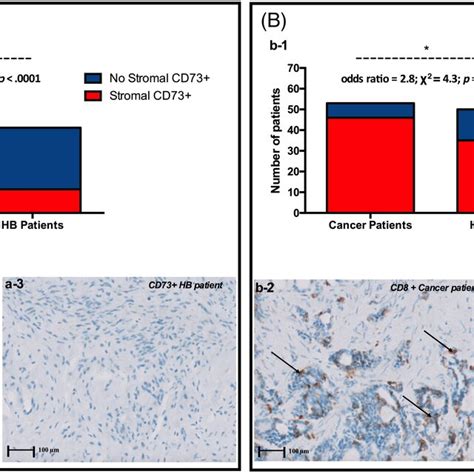 A Stromal Cd73 Cells Distribution Cancer Versus Bph Patients A1