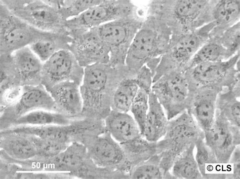 U 2 Os Cell Line Human Osteosarcoma Cells Cls