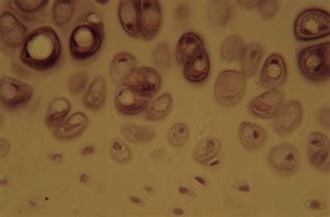 Lab Quiz Flashcards Quizlet