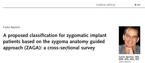 Study The Science Behind Zaga Concept For Zygomatic Implants