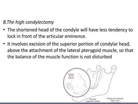 Clinical Features Presentation Clinical And Surgical Management Of Tmj