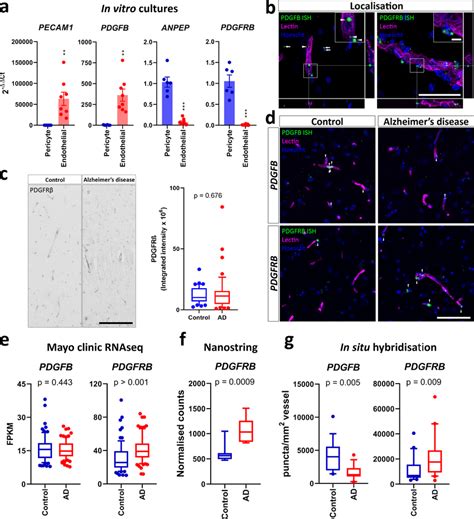 PDGF BB PDGFRβ signalling components are altered in the AD Download Scientific Diagram