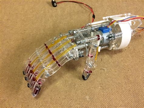 Low Cost Prosthesis By Matthew Thompson At