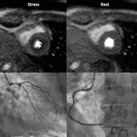 Fast Spin Echo Sequence Download Scientific Diagram