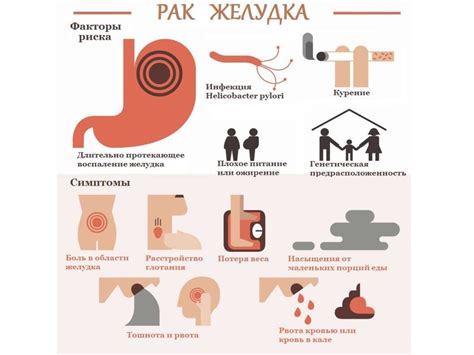 Рак желудка презентация онлайн