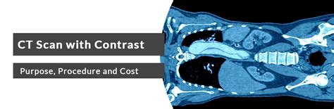 CT Scan With Contrast Purpose Procedure And Cost