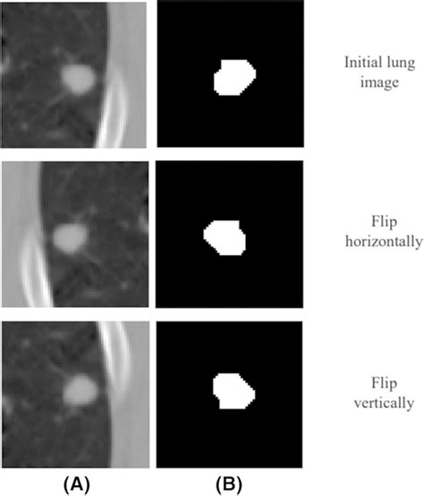 data augmentation of corresponding image and ground truth patch