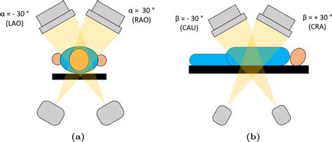 x ray source angulations the orbital lao rao and the angular