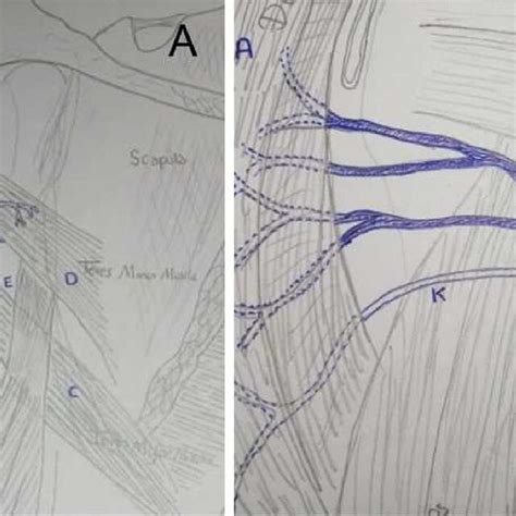 Drawn Diagrams By The Authors Showing The Axillary Nerve And Its