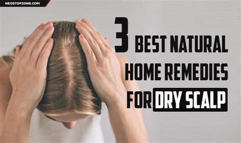 3 Best Natural Home Remedies For Dry Scalp