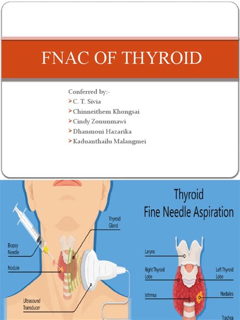 Fnac Of Thyroid 102717 Pdf Cytopathology Medicine