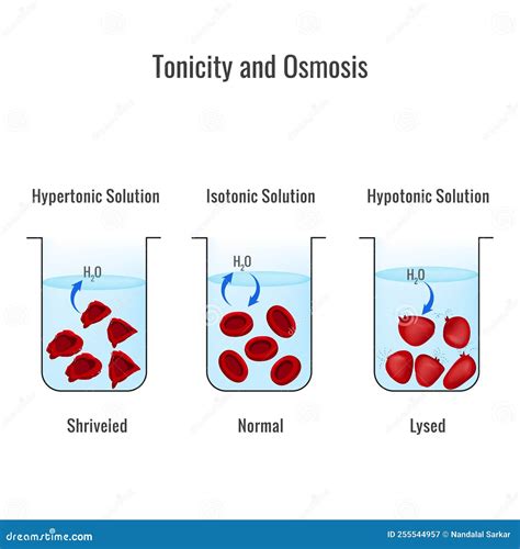Diagram Of Hypertonic Solution Headline News