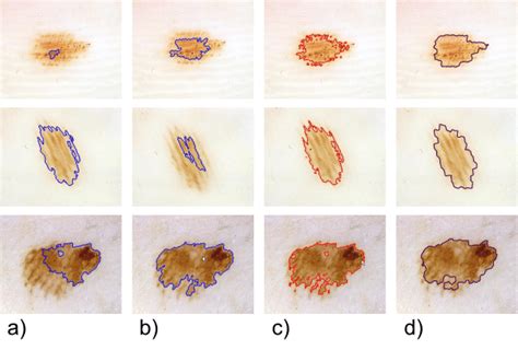 Segmentation Results Obtained Using Different Approaches A Active Download Scientific