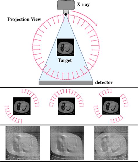Figure 1 From Learning Projection Views For Sparse View Ct Reconstruction Semantic Scholar