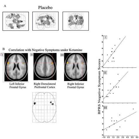 Verbal Working Memory Task See Results And Table 1 Continuous