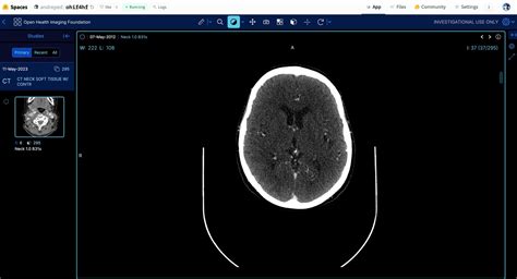 How To Deploy With Port Redirect Proxy With Nginx Spaces Hugging Face Forums