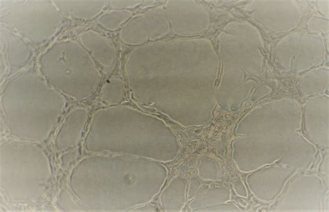Endothelial Cells Tube Formation Assay In Vitro Assays For Angiogenesis Straticell