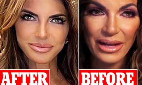 Teresa Giudice Looks Unrecognizable As Doctors Reveal What 60 Off