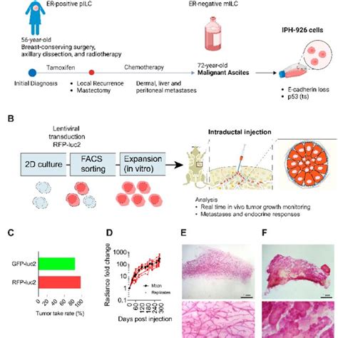 Focus Of Solid Papillary Carcinoma Showing A Monotonous Population Of Download Scientific