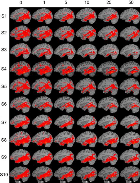 Figure 5 5 From Ventral Occipito Temporal Cortex Function And