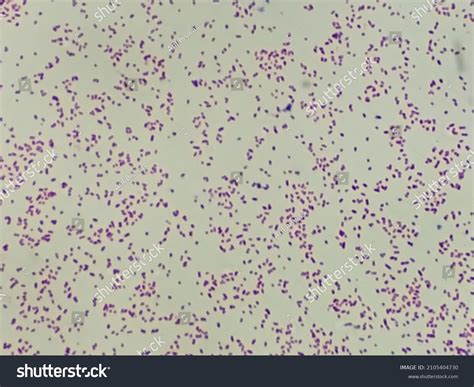 Bacterial Vaginosis Gram Stain