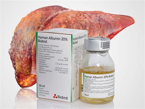 Study Questions Albumin Use In Decompensated Cirrhosis Faculty Of