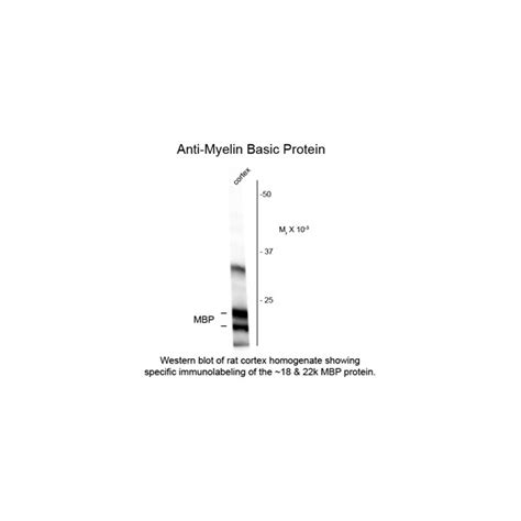 Buy Myelin Basic Protein Mbp Antibody Axil Scientific