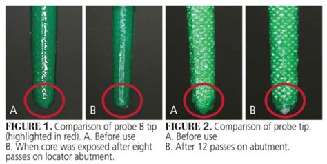 Do Probe Markings Impact Implant Health Decisions In Dentistry