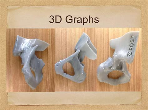 Acetabular Fracture Radiology Xrays Ct Scan And 3d Printing Pptx