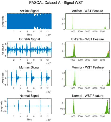 Applied Sciences Free Full Text Heart Sound Classification Using Wavelet Analysis Approaches