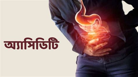 অ্যাসিডিটিতে ভুগছেন৬টি নিয়মে ঘরোয়াভাবেই সমাধান করুন