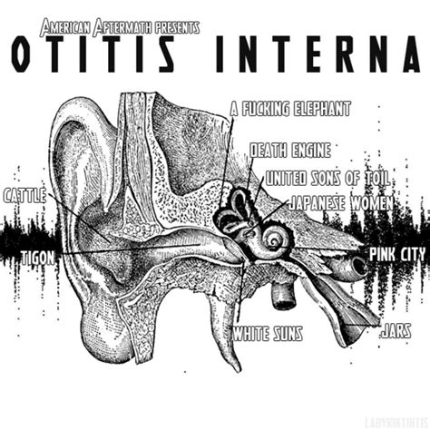 Otitis Interna American Aftermath