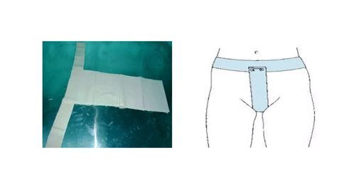 Binder And Splint Ppt Pptx