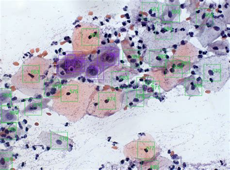 Image Example From The Cervical Cell Classification Collection Download Scientific Diagram