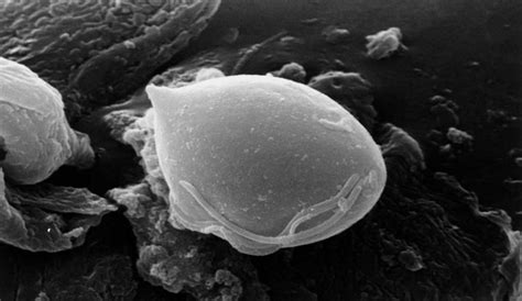 Sex And Another Silent Infection Public Health Post