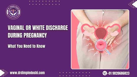 White Vaginal Discharge During Pregnancy