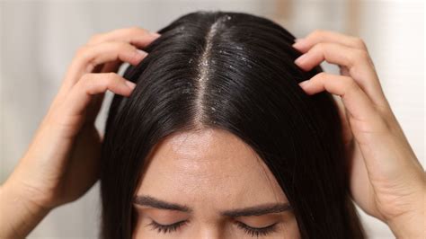 Beyond Hair Loss Understanding Your Scalp Microbiome And Why A Head