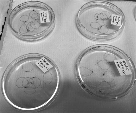 Suture Loops In Petri Dishes Before Placement In Incubators Monocryl