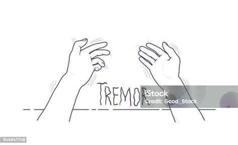 손 떨림입니다 악수의 1 인칭 뷰입니다 파 킨 슨 병 증상 의료 벡터 그림 흰색 배경에 고립입니다 가시에 대한 스톡 벡터 아트 및 기타 이미지 Istock
